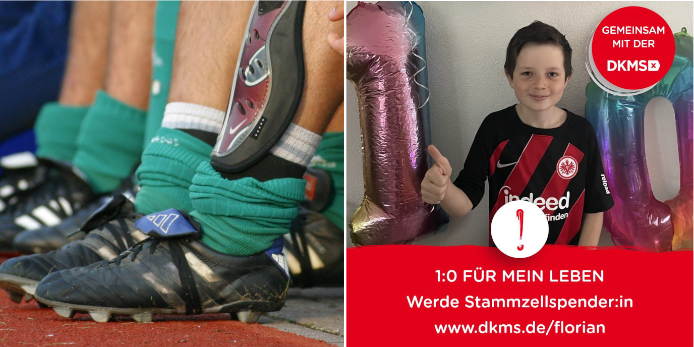 Landesliga-Eröffnungsspiel am 19.07. in Rimpar – Motto: „Mund auf. Stäbchen rein. Spender/in ...